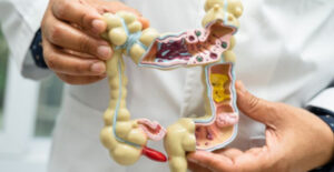 Gut Health Meaning: What It Really Means for Your Body